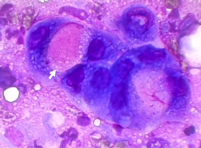 Melamed-Wolinska body :: 獸醫好想告訴你